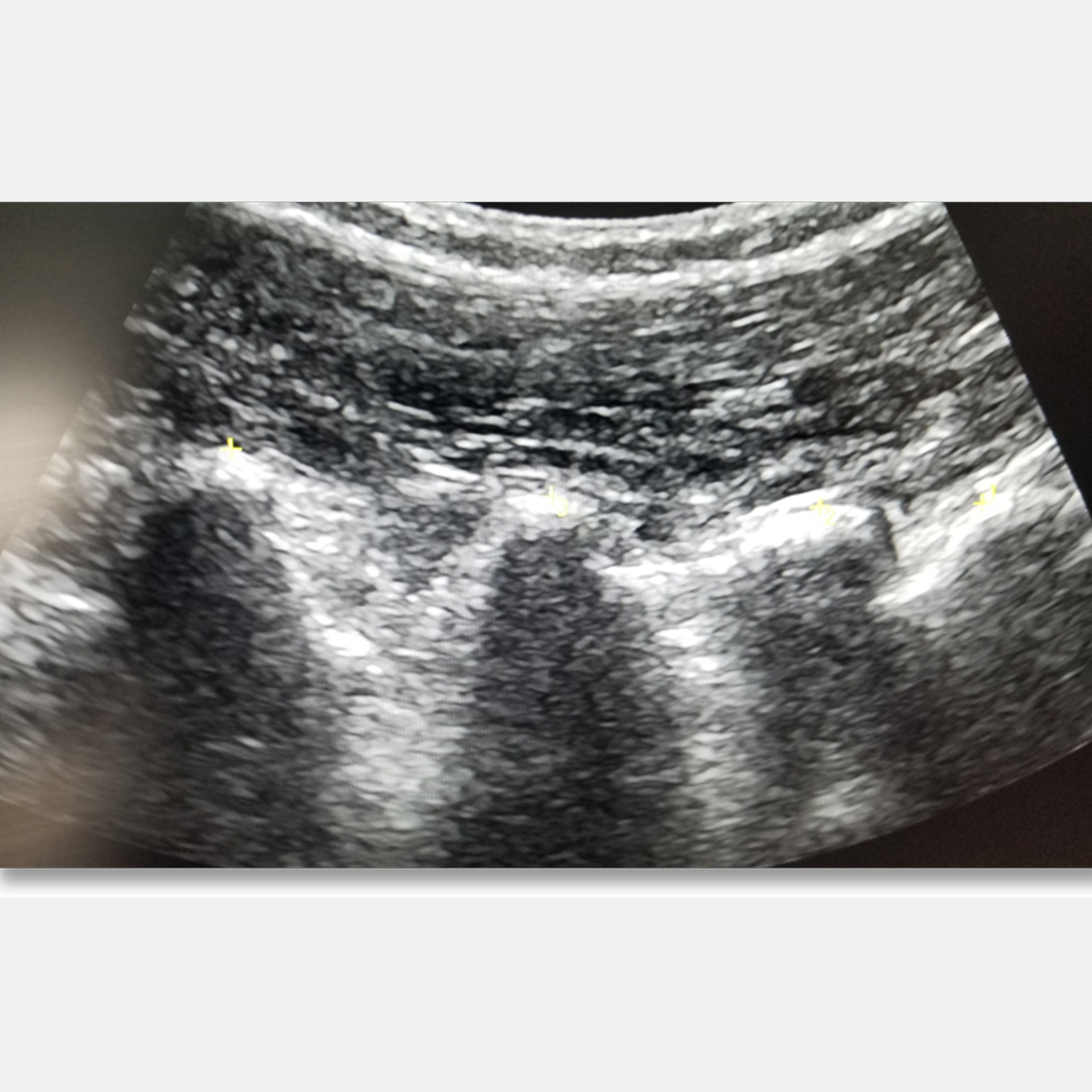 Inside Your Spine: What Happens During Fernandina Beach Flexion ...